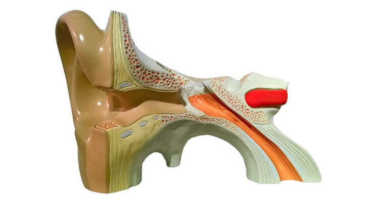 Eustachian Tube Problems - ENT Doctor | Ear and Tinnitus Specialist ...