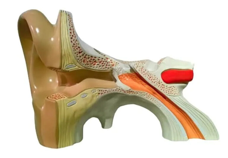 Petrous Apex Lesions - ENT Doctor | Ear and Tinnitus Specialist | Hamid ...